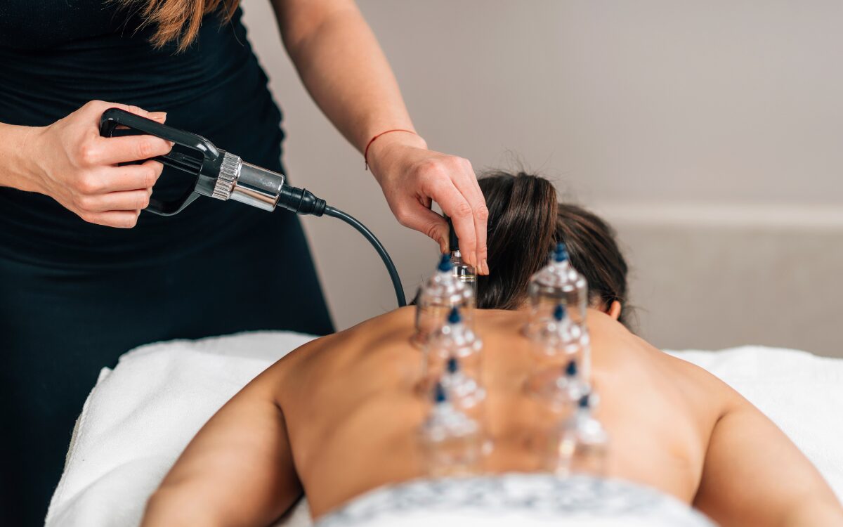 Ventosaterapia: Descubra os benefícios da ventosaterapia para a sua saúde - Reabilitando ...